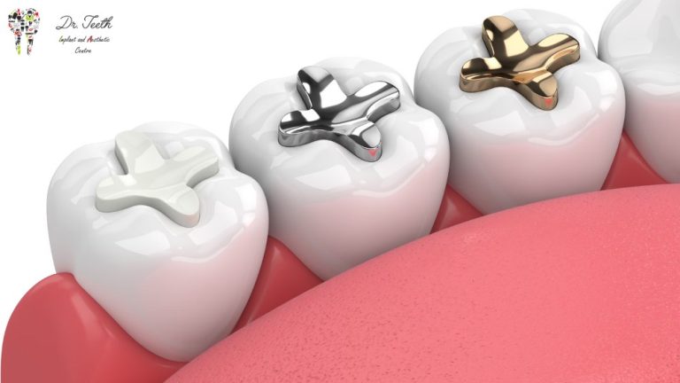 Dental Filling Types & How to Choose the Right One