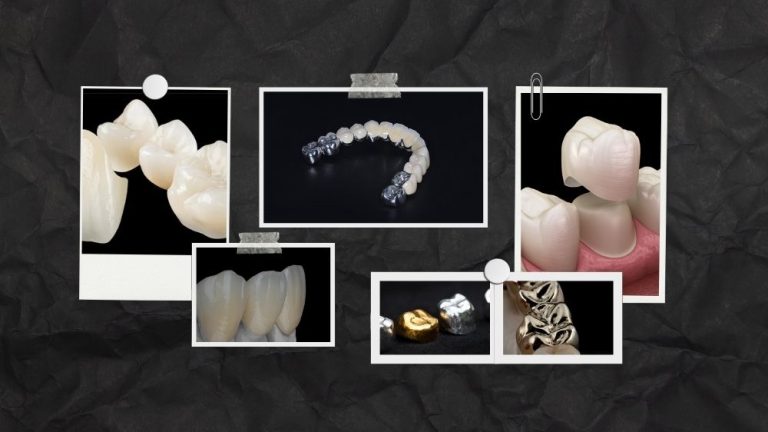 Types of Dental Crowns & Their Benefits Explained